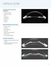 Cataract AIOL | ArcScan